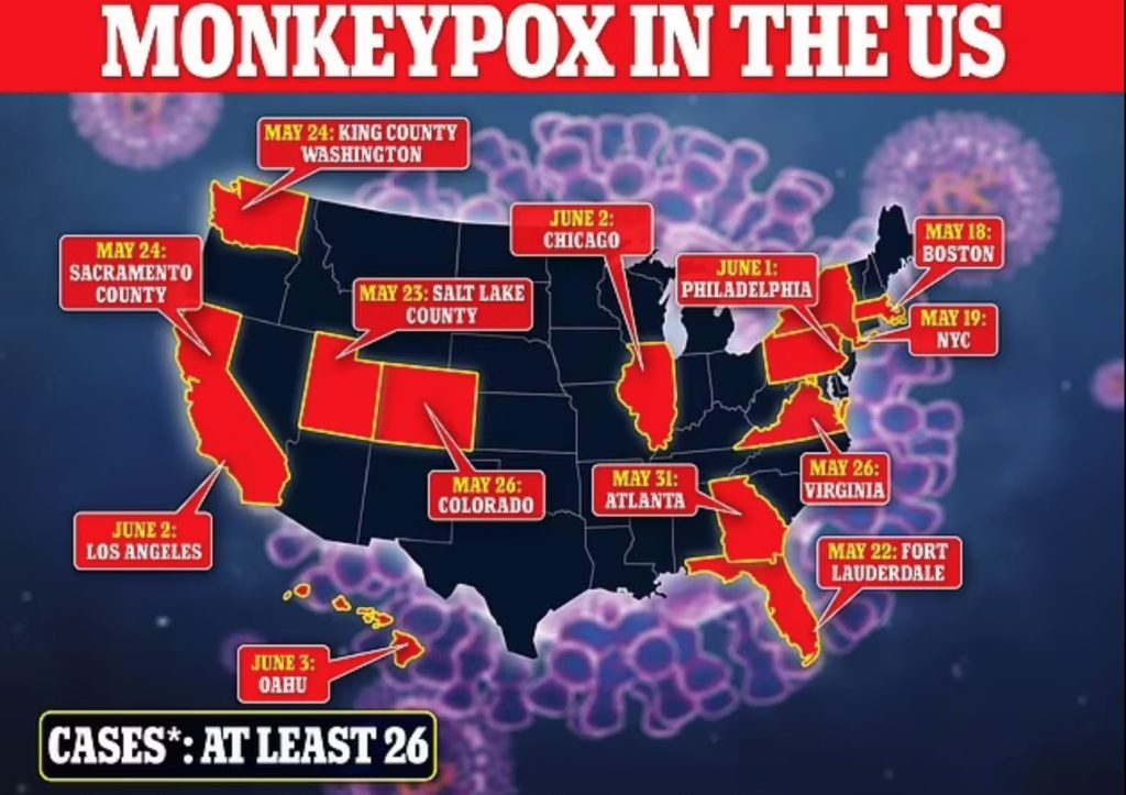 Monkeypox: "we don’t really know whether it is too late to contain ...